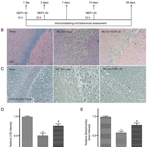 Representative Images Showing Lfb And Bielschowsky Silver Staining In Download Scientific