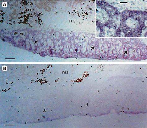 Figure 6 From Gonadal Morphogenesis And Gene Expression In Reptiles