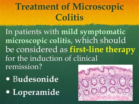 Medical Treatment Of Microscopic Colitis