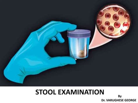 Stool Examination Pptx