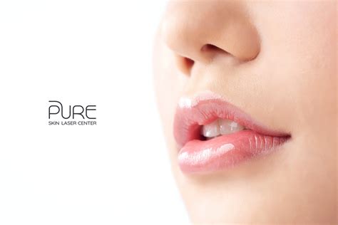 Cupids Bow Lips Can Botox Or Lip Fillers Help Define Your Lip Shape