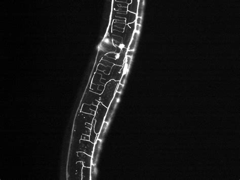 Optical Neuron Recordings And Manipulations Lµ Fluidics Group