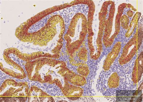 Intensity Of Staining In Qupath Image Analysis Imagesc Forum