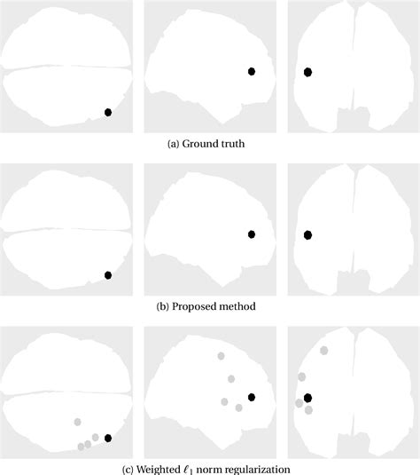 Figure 21 From Bayesian Meeg Source Localization With Possible Joint Skull Conductivity