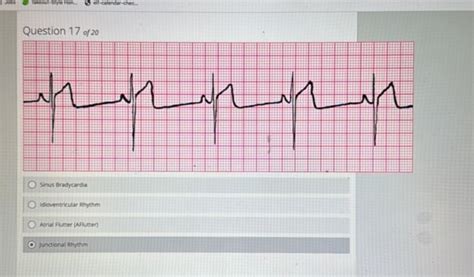 Question 17 Of 20 Image Of Ecg Sinus Bradycardia Idioventricular Rhythm Atrial Flutter Aflutter