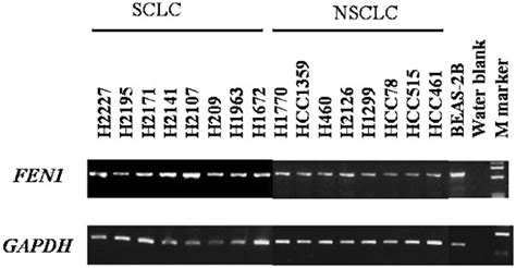 Increased Expression And No Mutation Of The Flap Endonuclease Fen1
