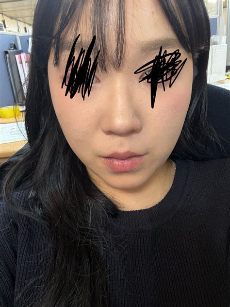 의사에게 물어보세요 선생님들 우선 미간 강남언니 1등 성형수술and피부시술 정보앱