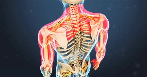 Secondary Va Claim Radiculopathy Combat Craig