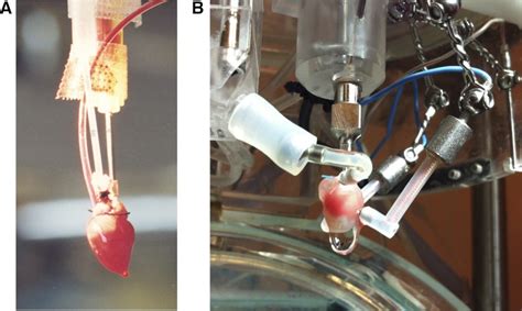 The Continuing Evolution Of The Langendorff And Ejecting Murine Heart