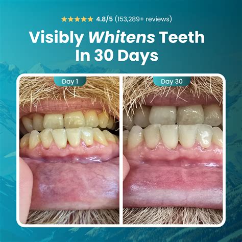 Larineco™️ Remineralizing Toothpaste For Stronger Teeth