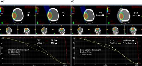 A Without Bolus The Calculated Scalp‐c Volume Receiving 3000 Cgy Was Download Scientific