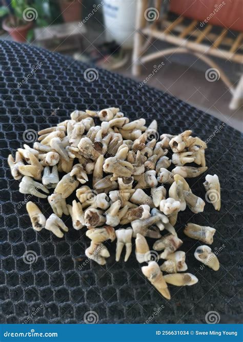 The Bundle Of Unwanted Extracted Decay Human Teeth Stock Photo Image Of Bundle Decay