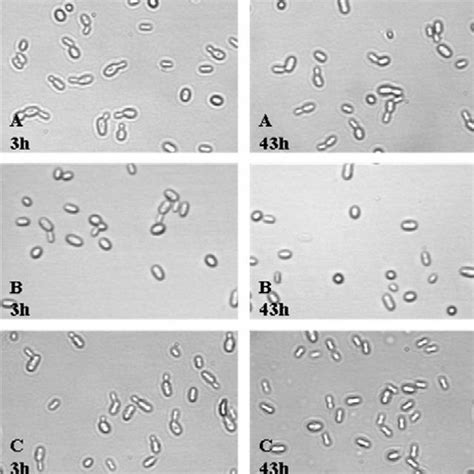 Pdf Candida Utilis Metabolism And Morphology Under Increased Air