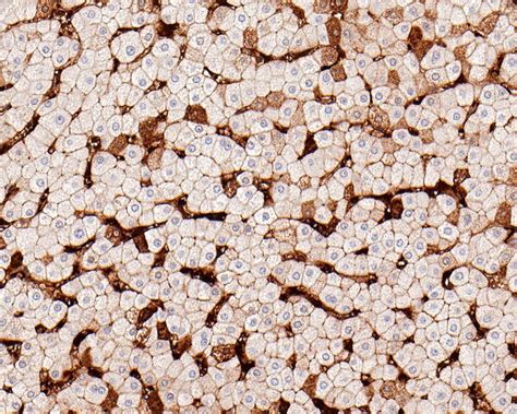 Hemoglobin Subunit Alpha Recombinant Rabbit Monoclonal Antibody Pd00