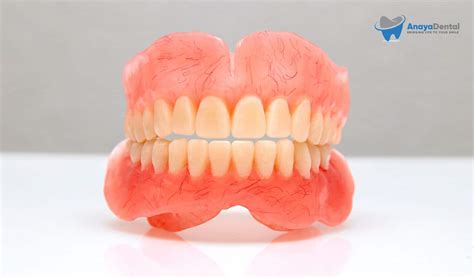 Valplast Partial Dentures Costs Benefits And Disadvantages Anaya Dental