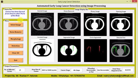 Automated Lung Cancer Detection In Medical Imaging Using Image