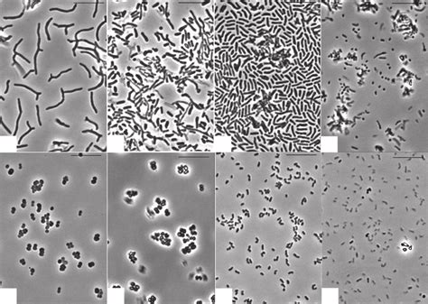 Vegetative A C E G And Cyst Like Cell Dormant B D F H Forms Of Download Scientific