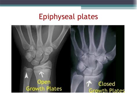Anatomy And Physiology Lecture Notes Skeletal System