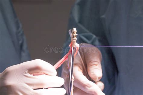 Knee Tendon Ligament Surgery Stock Image Image Of Doctor Equipment