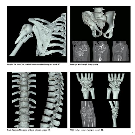 Computed Tomography 128 Slices Multi Slice Ct ‣ Medical Technologies