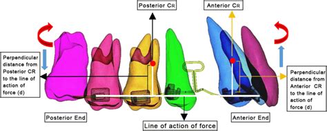 Comparative Assessment Of The Efficacy Of Closed Helical Loop And T