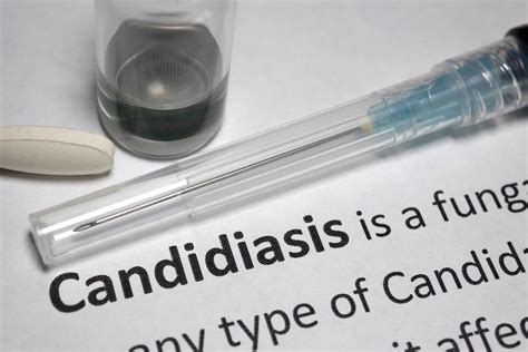 Vulvovaginal Candidiasis Discharge Vulvovaginal Candidiasis Discharge