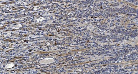 Alpha B Crystallincryab Antibody