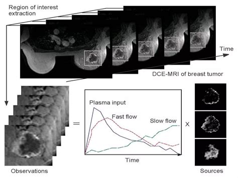 Magnetic Resonance Imaging Ppt