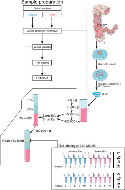 Proteomic Profiling Of Tumour Tissue‐derived Extracellular Vesicles In