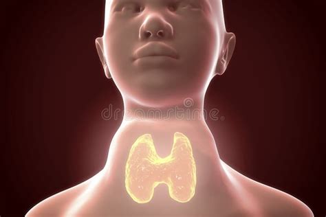 Toxic Diffuse Goiter Stock Illustration Illustration Of Biology 104687913