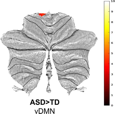 Between Group Asd Vs Td Differences Of Connectivity Between