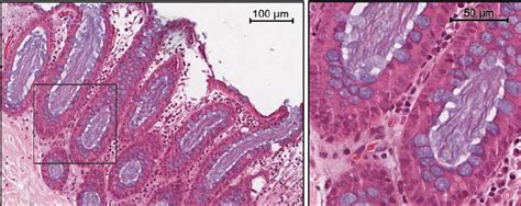 Histological Features Of Normal Colon Tissue In Organ Culture