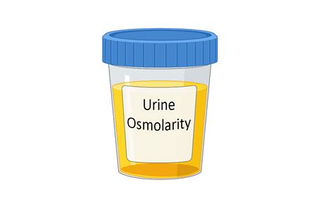 Urine Osmolality Test Tube Color At Nelda Butler Blog