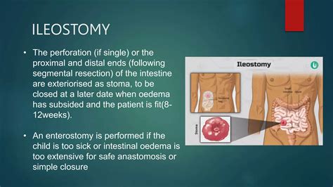 Typhoid Perforation Pptx
