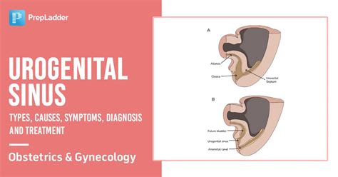 Urogenital Sinus Types Causes Symptoms Diagnosis And More