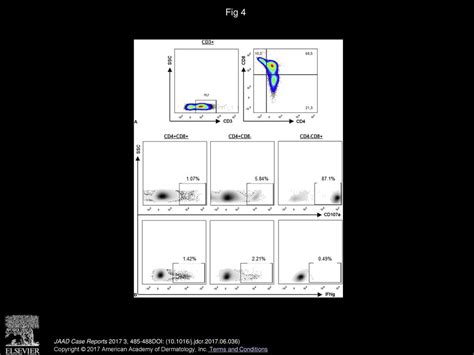 Double Positive Cd4 And Cd8 Sézary Syndrome Ppt Download