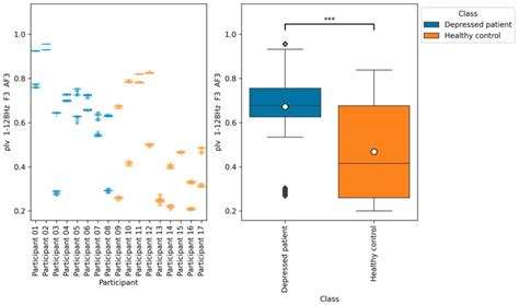 Machine Learning Based Depression Detection Model From