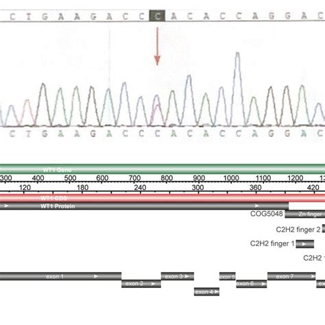 A Sanger Sequencing Chromatogram Shows The Double Peak C T In Wt1