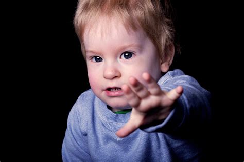 Prader Willi Syndrome Infant