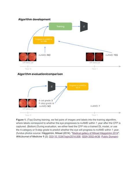 Predicting Progression Of Age Related Macular Degeneration From Fundus Images Using Deep