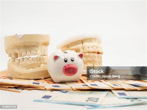 치과 캐스트 돼지 저금통 및 흰색 배경에 지폐 치아의 석고 모델입니다 0명에 대한 스톡 사진 및 기타 이미지 0명 가격 개념 Istock
