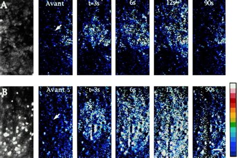 Effect Of Neurons On The Extent Of Calcium Wave Propagation In