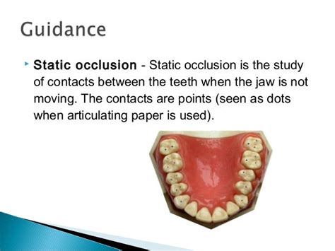 Occlusion Occlusion