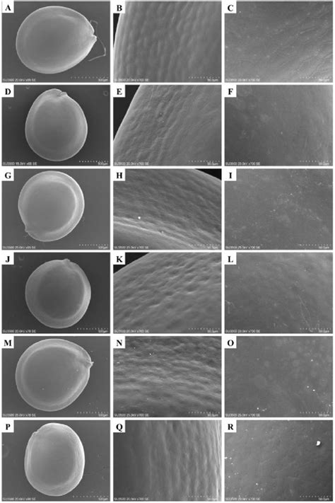 Sem Micrographs Of Amaranthus Seeds A C A Caudatus D F A Download Scientific Diagram