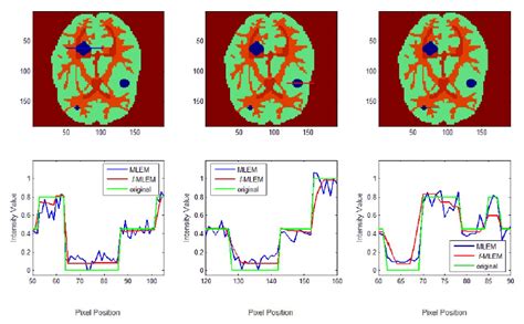 Tomography Free Full Text A Novel Iterative Mlem Image