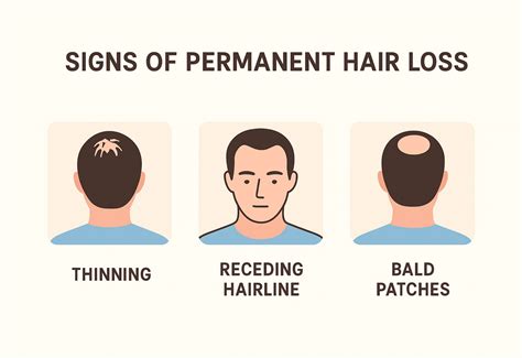 How To Identify Permanent Hair Loss Key Signs And Symptoms