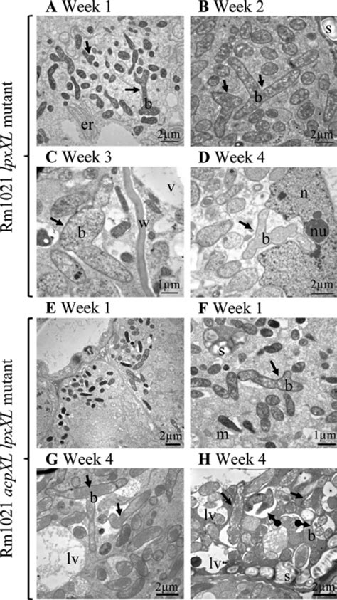 Bacteroid Abnormalities For The S Meliloti Lpxxl Single Mutant And