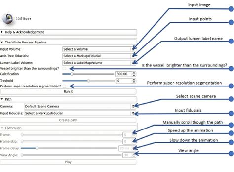 GitHub Gaoyi SlicerVirtualEndoscopy