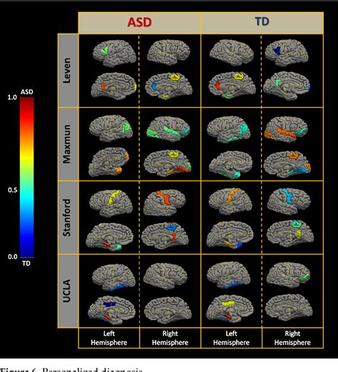 Figure 6 From The Role Of Structure Mri In Diagnosing Autism Semantic Scholar