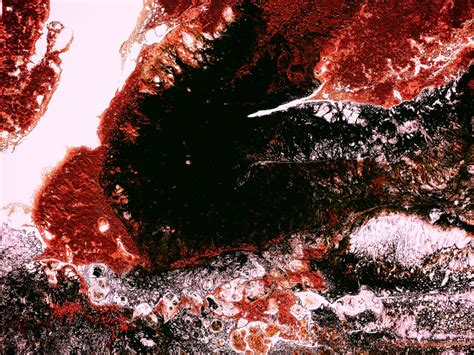 Spatial Imaging In Clinical Research Opportunities And Challenges Associated With Spatial Data